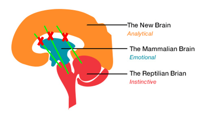 Trauma: Its Effects on Our Life and Our Mindsets - Ryan Gottfredson